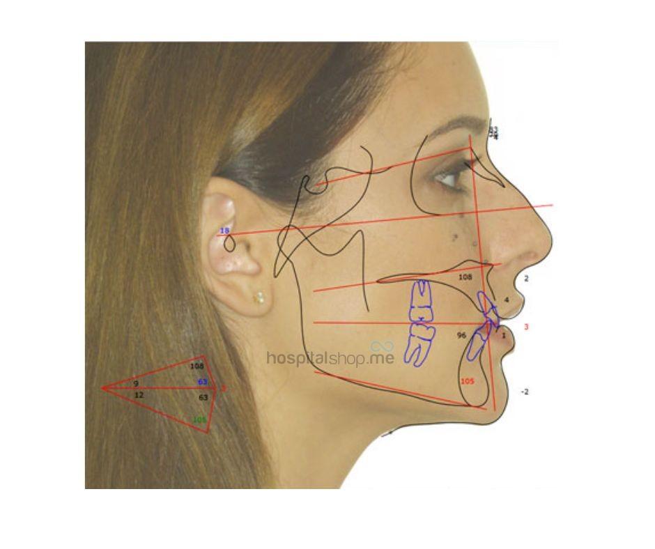 Dolphin Imaging Support Dental Software