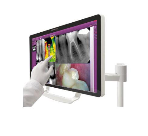 Mocom Intra Oral Camera and Monitor